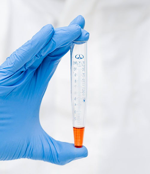 Gallery | Advanced Chemical Solutions